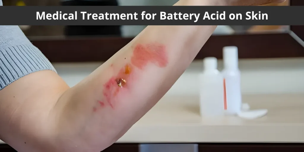 Battery Acid On Skin: Why It's Dangerous And How To Stay Protected ...